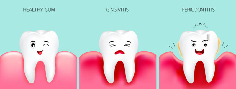 Gum Pain: What It Can Mean - My Dentist Toluca Lake
