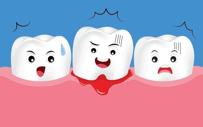 A Bleeding Socket after Tooth Extraction - My Dentist Toluca Lake