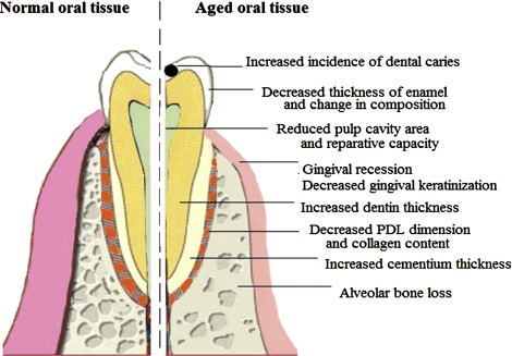 Tooth Loss And Ageing - My Dentist Toluca Lake
